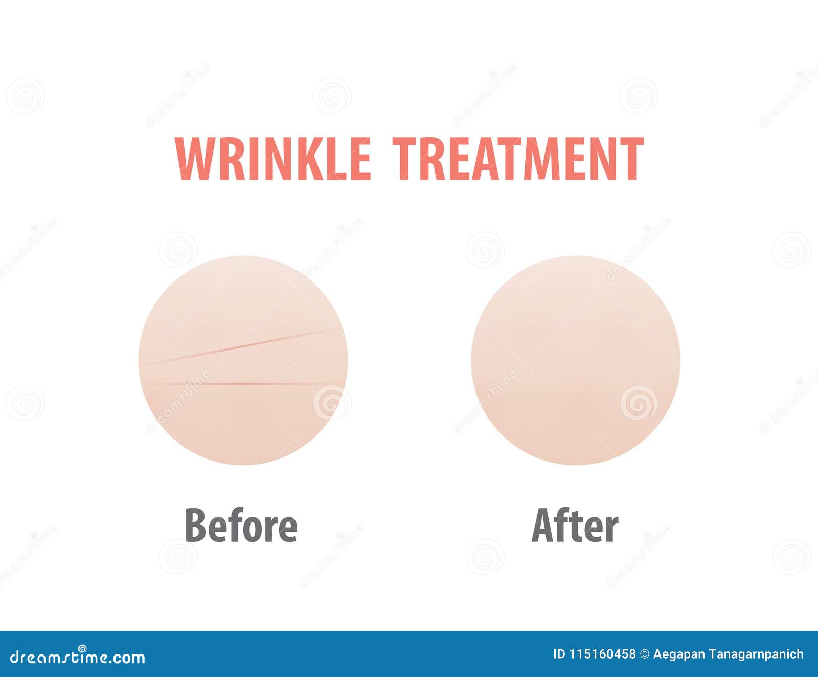 Wrinkle Treatment Comparison Illustration Vector on White Background ...