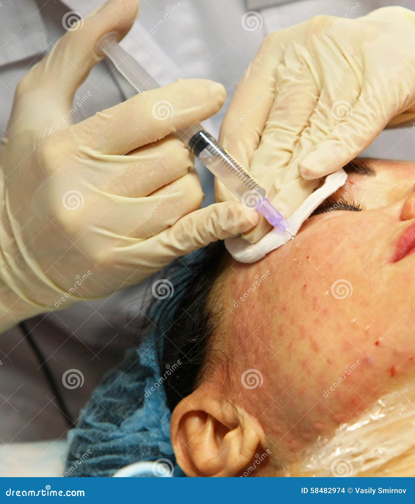 Wrinkle Treatment Injecting Stock Photo - Image of head, face: 58482974