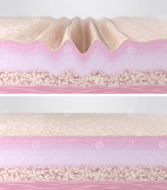 Wrinkled Aged And Young Smooth Skin Comparison Stock Illustration