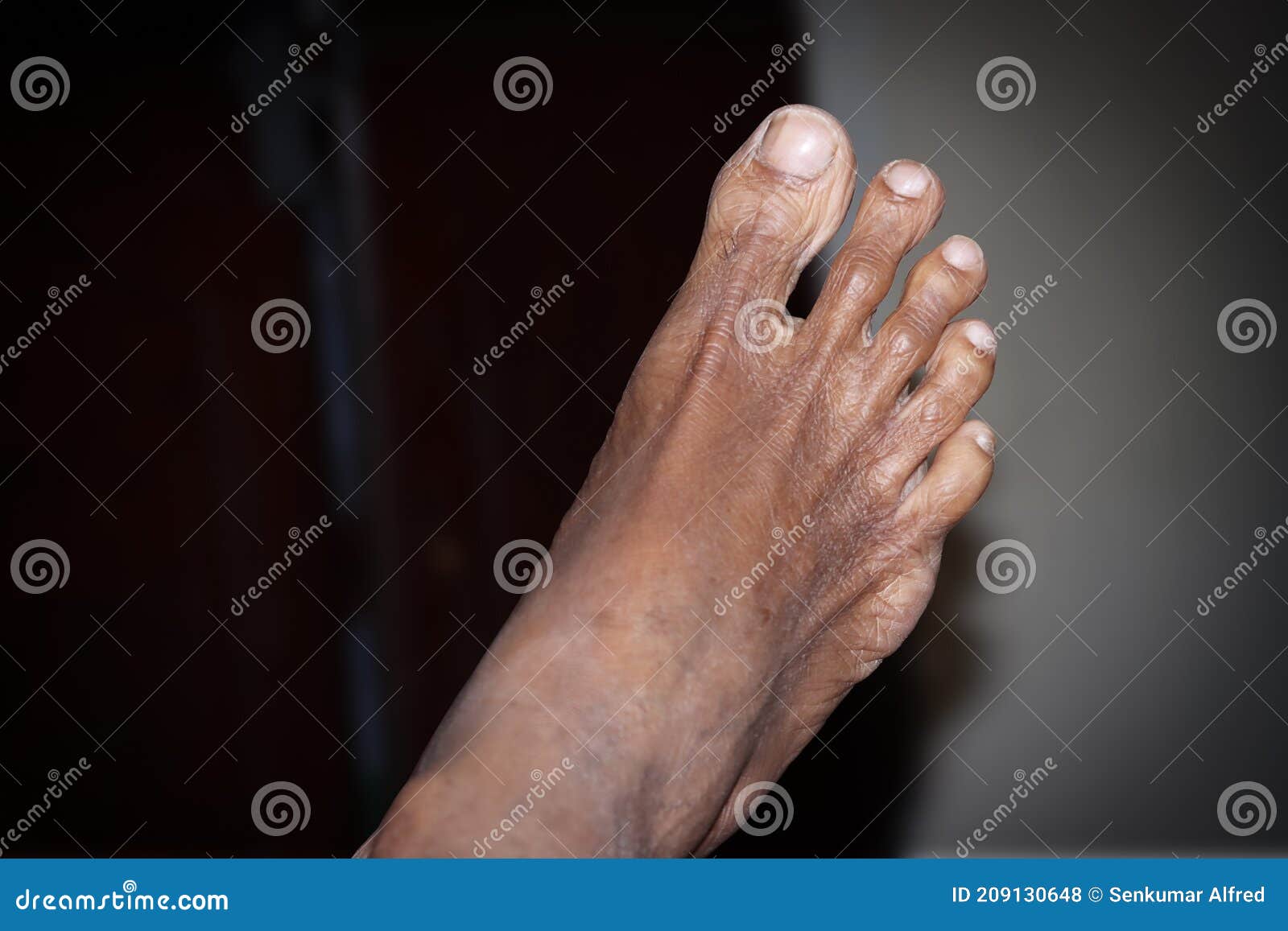 Wrinkled Foot stock photo. Image of aging, health, fingers - 209130648