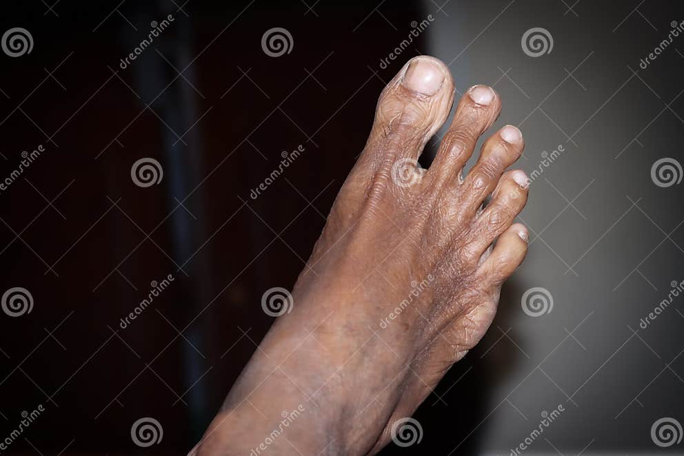 Wrinkled Foot stock photo. Image of aging, health, fingers - 209130648