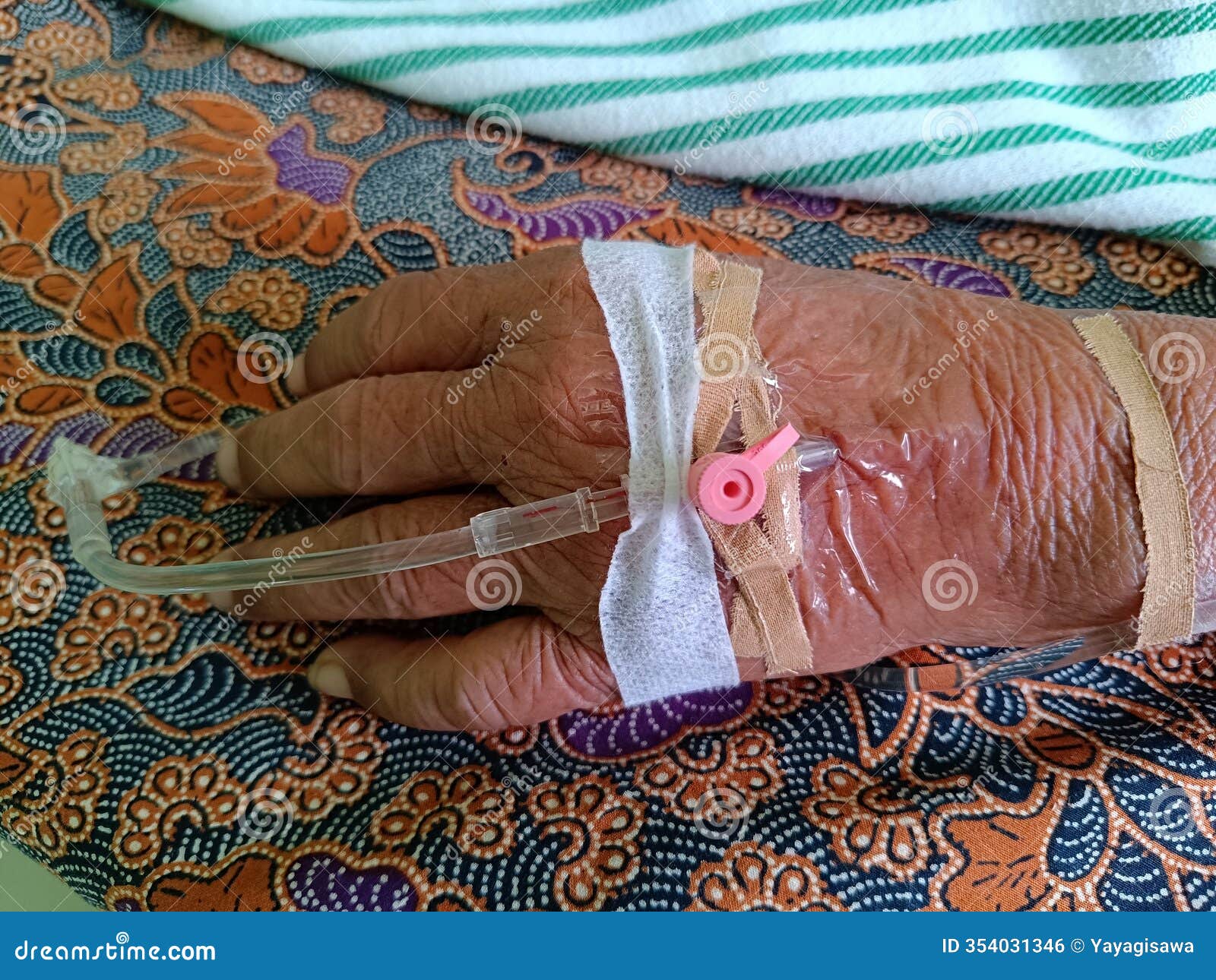 Wrinkled Hands of a Sick Old Man with an IV Drip Attached Stock Photo ...