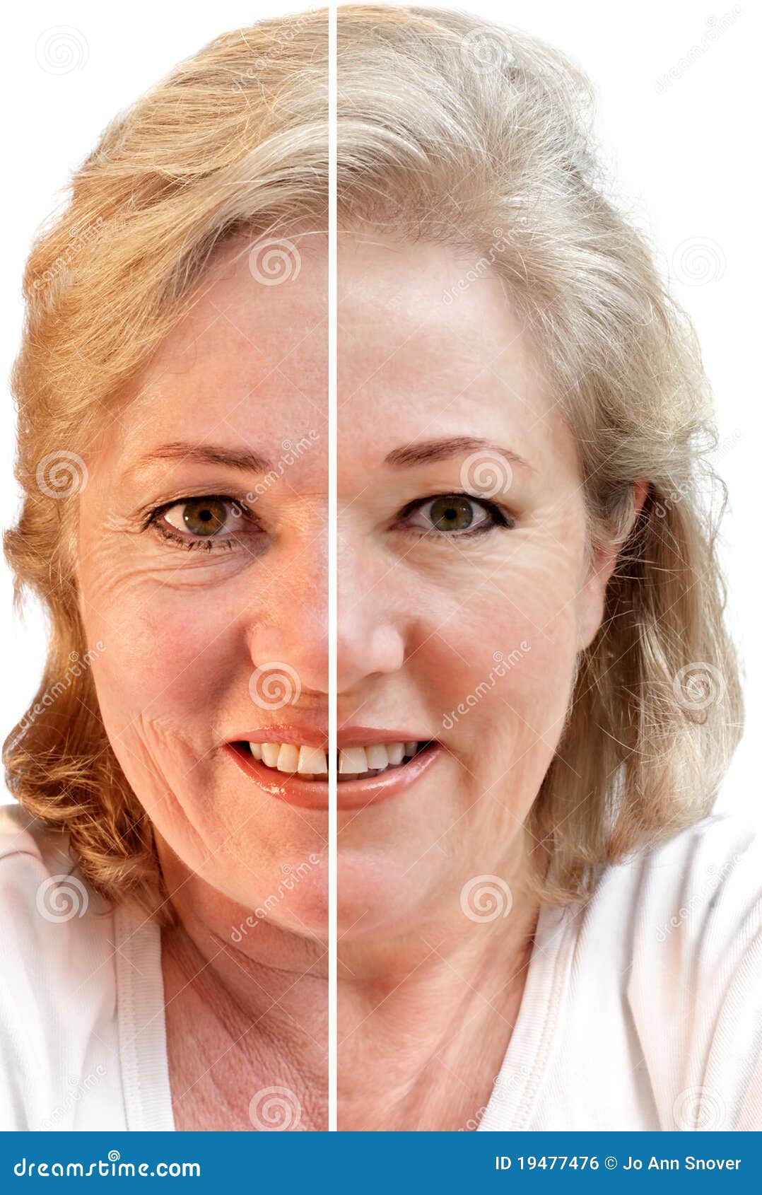 Wrinkled or smooth skin stock photo. Image of cosmetic - 19477476