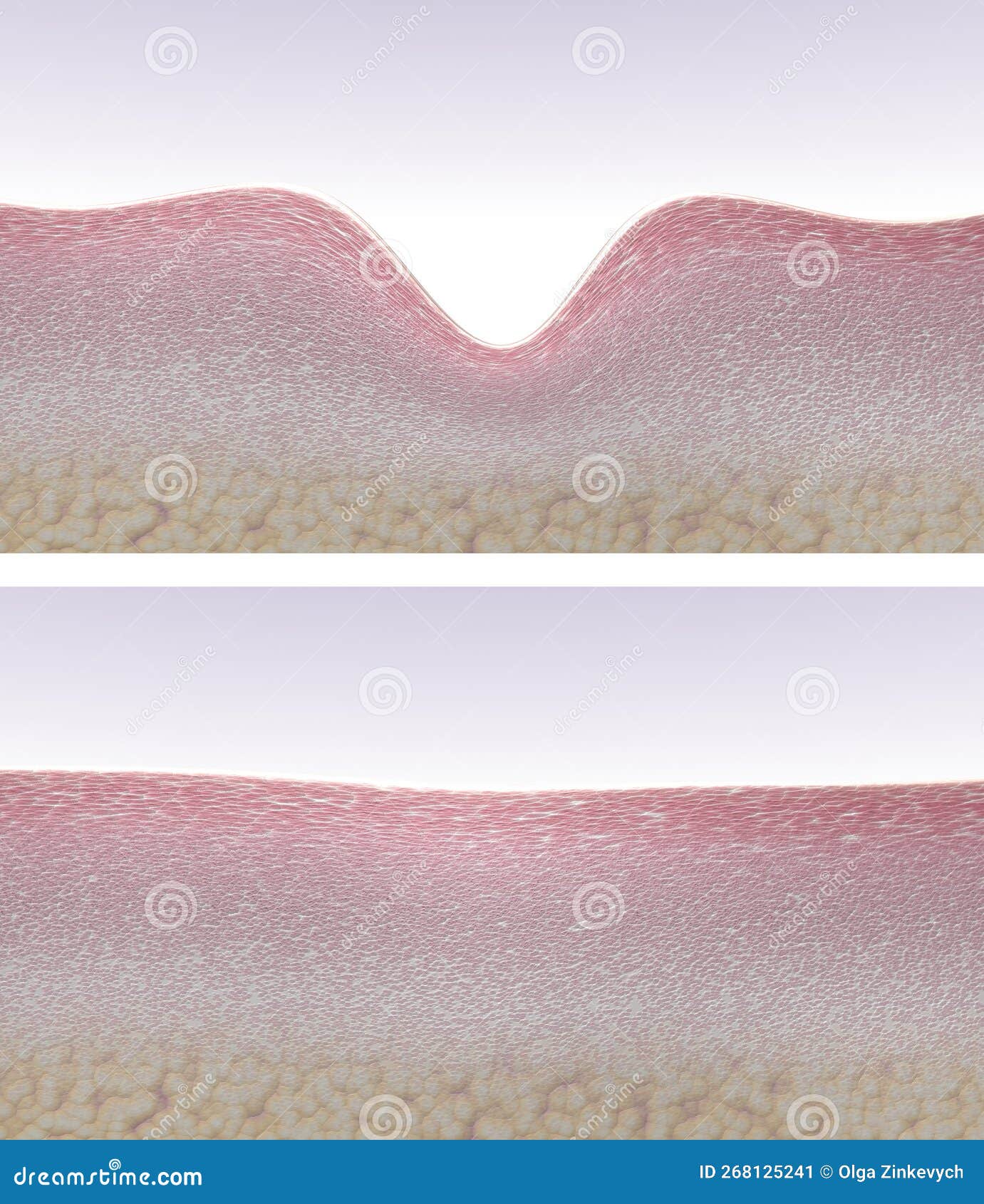 Wrinkled And Smooth Skin Cross Section 3d Render Stock Illustration