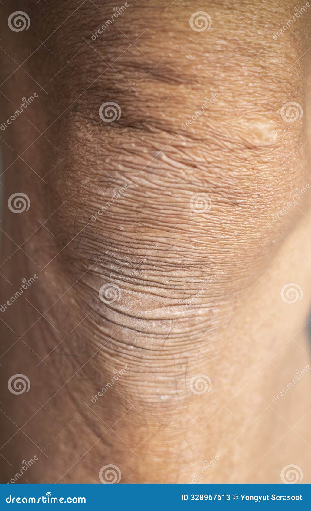 Wrinkles and Rough Skin on the Knees Stock Image - Image of grotesque ...