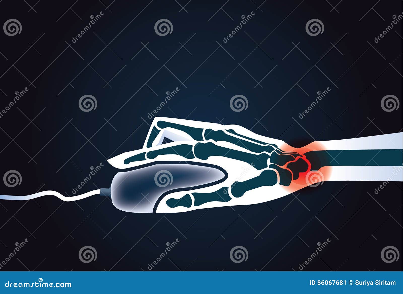 Wrist Bone Have A Redness Signal While Using Mouse. Cartoon Vector ...