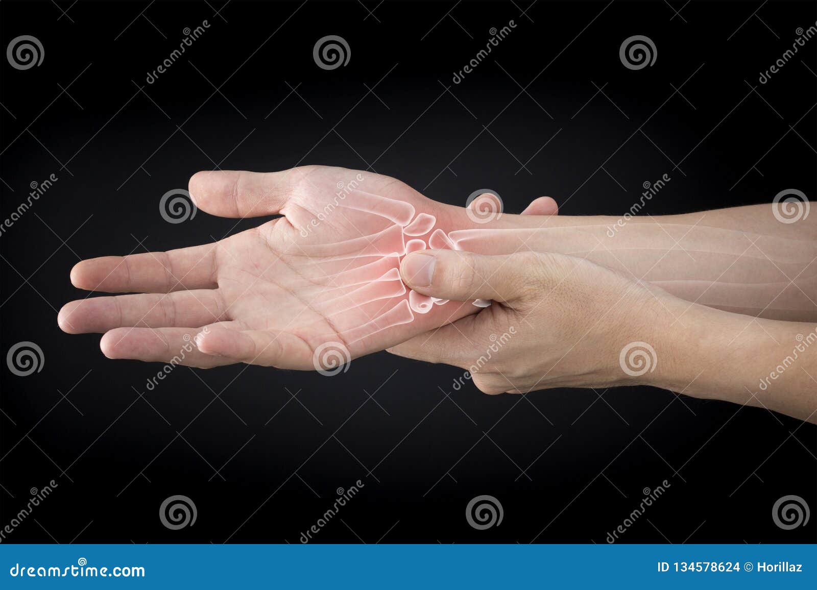 Wrist bones injury stock photo. Image of cramp, office - 134578624
