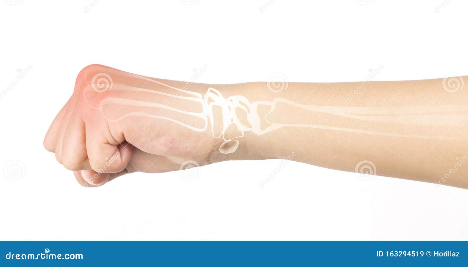 Wrist bones injury stock image. Image of injury, cramp - 163294519