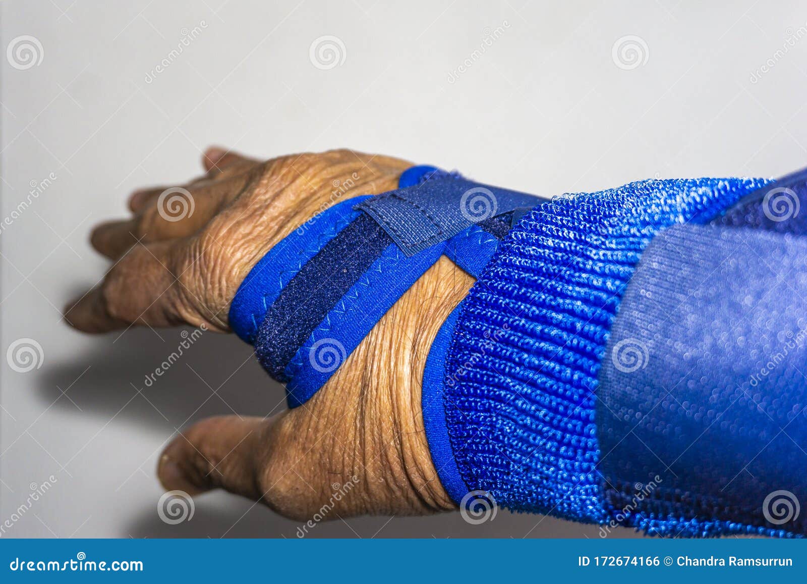 Wrist Brace for Twisted Hand Stock Photo - Image of isolated, pain ...
