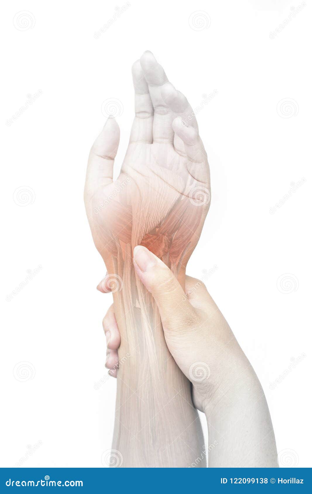 Wrist Extensor Retinaculum Injury