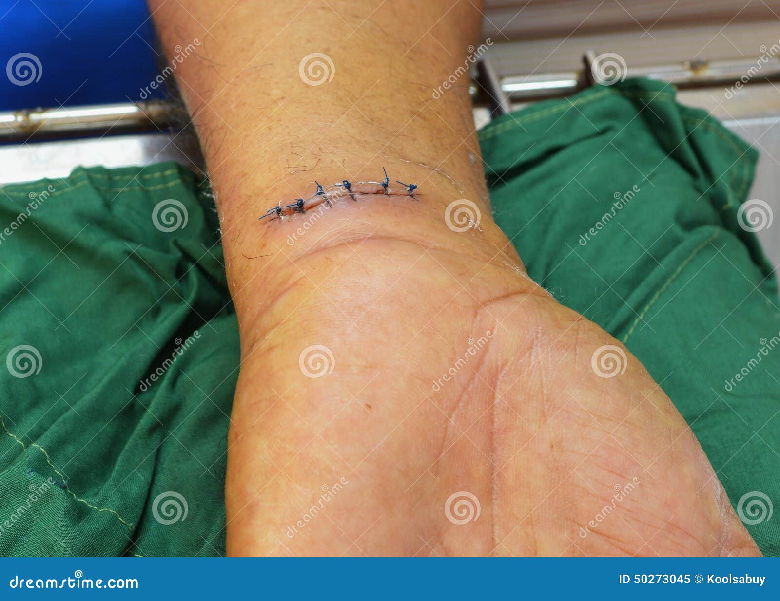 1,906 Sterile Cloth Photos - Free & Royalty-Free Stock Photos from ...