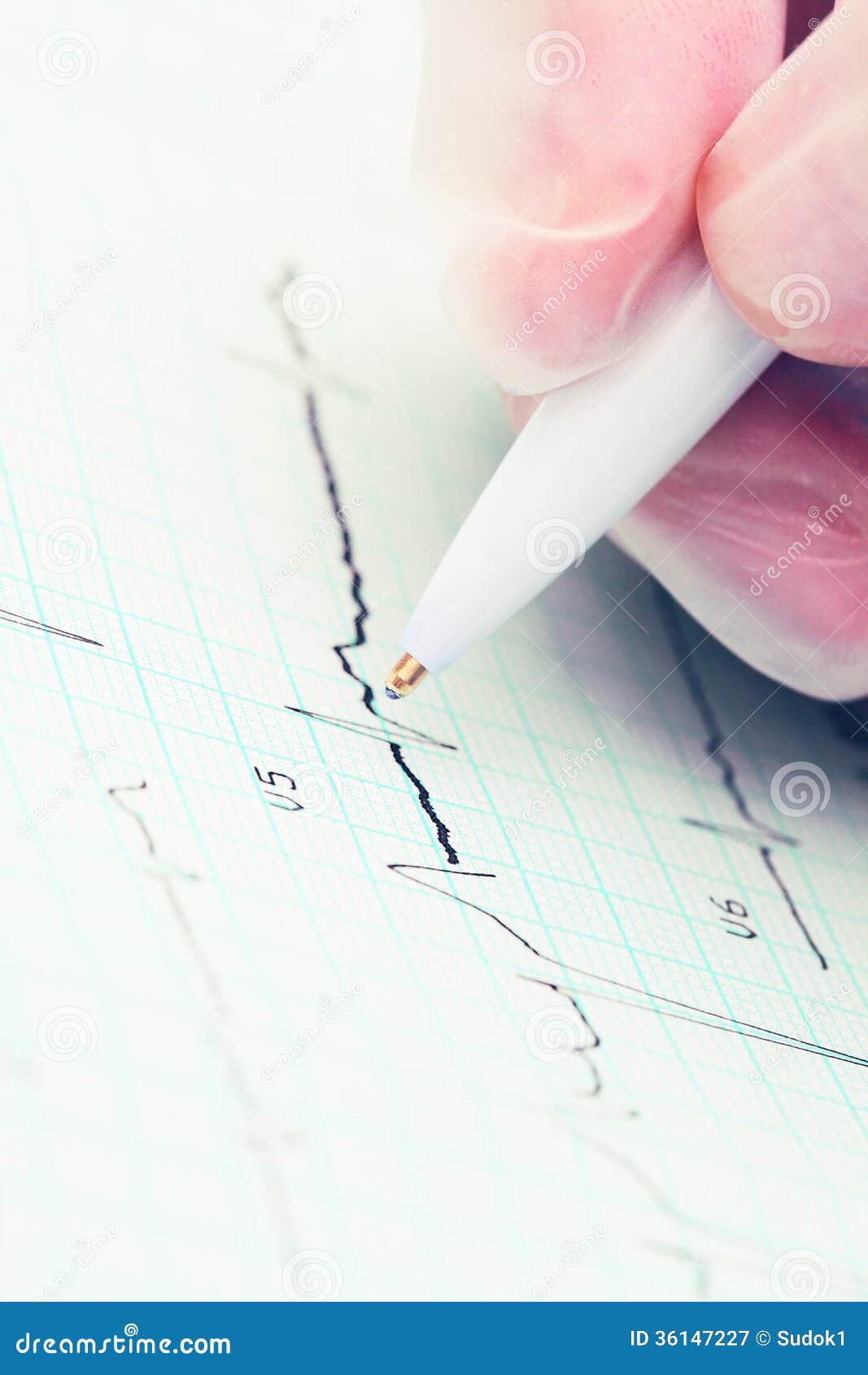 Writing on paper ECG. stock image. Image of glove, medicine - 36147227
