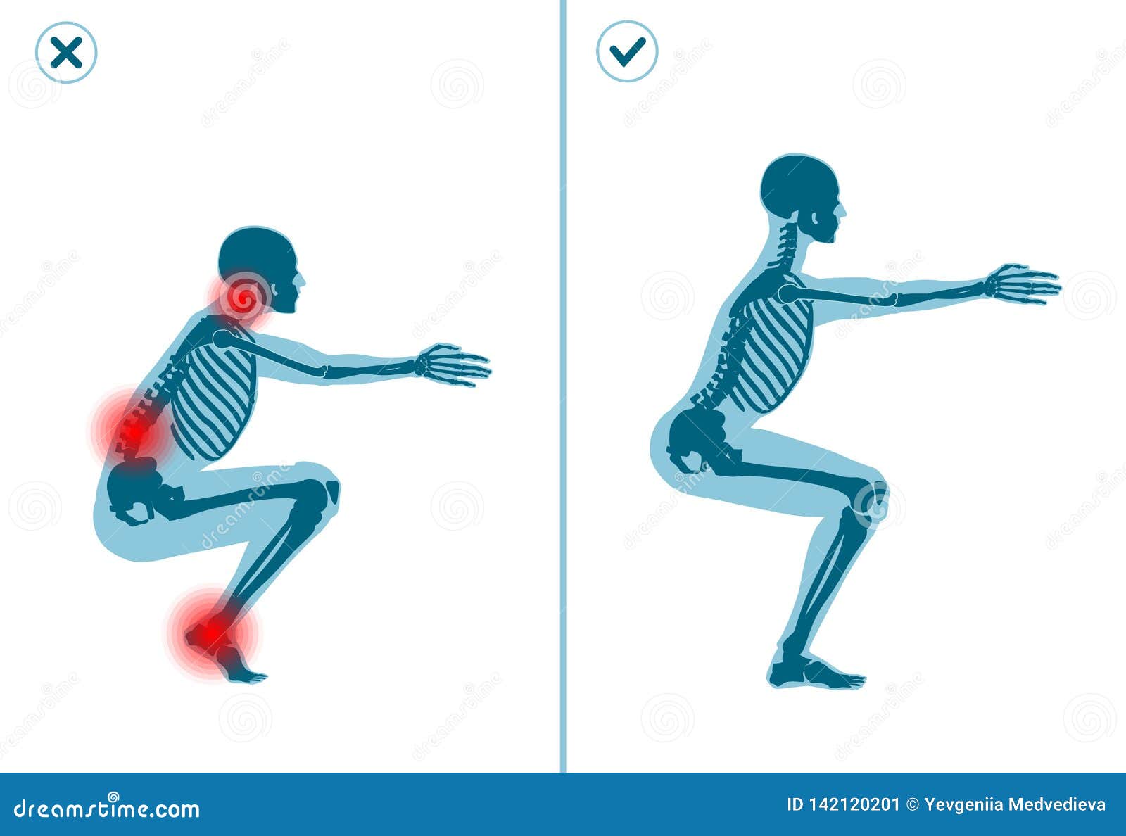 Exercise Right Stock Illustrations – 3,901 Exercise Right Stock ...