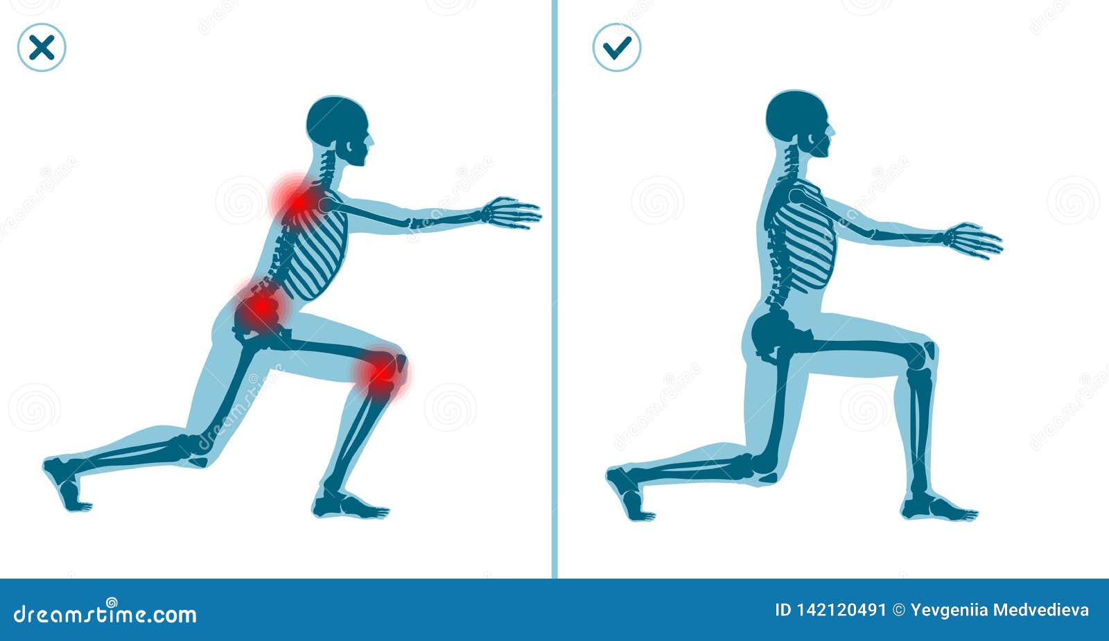 Wrong and Correct Lunges Exercise. Right Execution Technique of Sport ... Wrong and Correct Lunges Exercise. Right Execution Technique of Sport ...