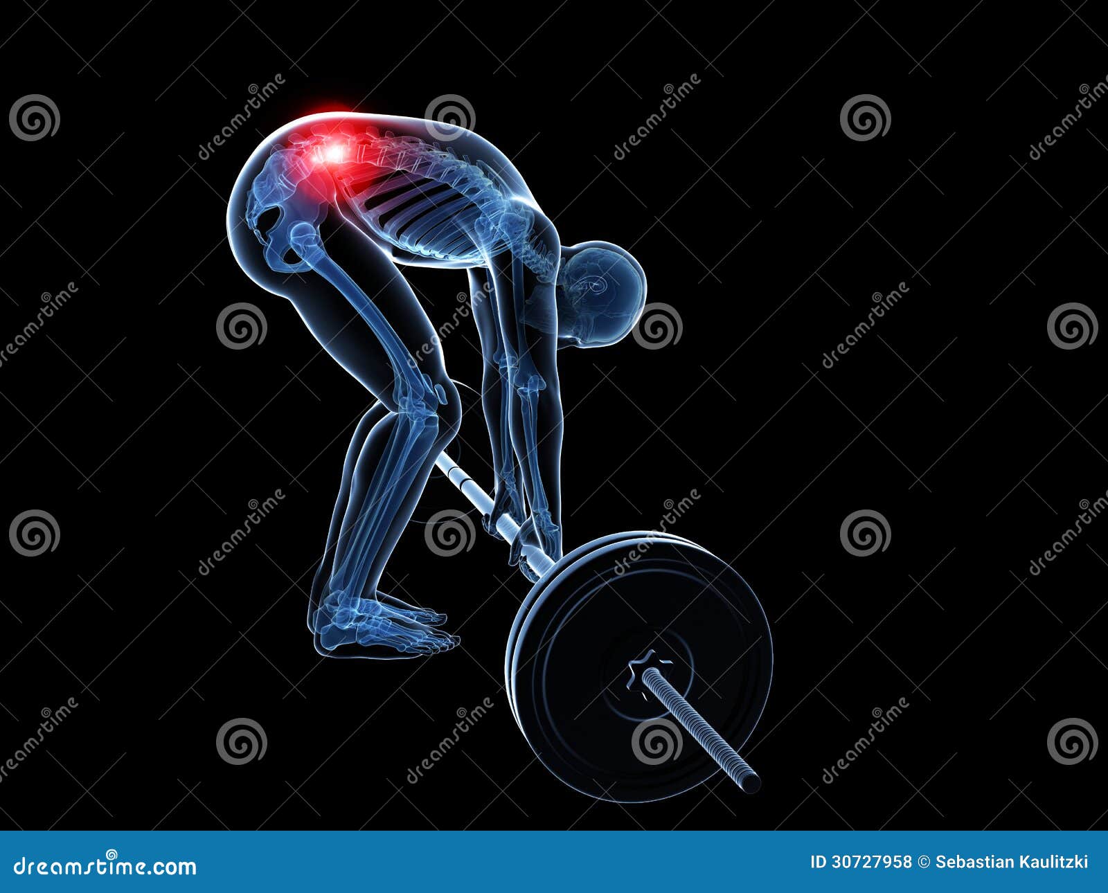 Wrong lifting posture stock illustration. Illustration of shoulder ...