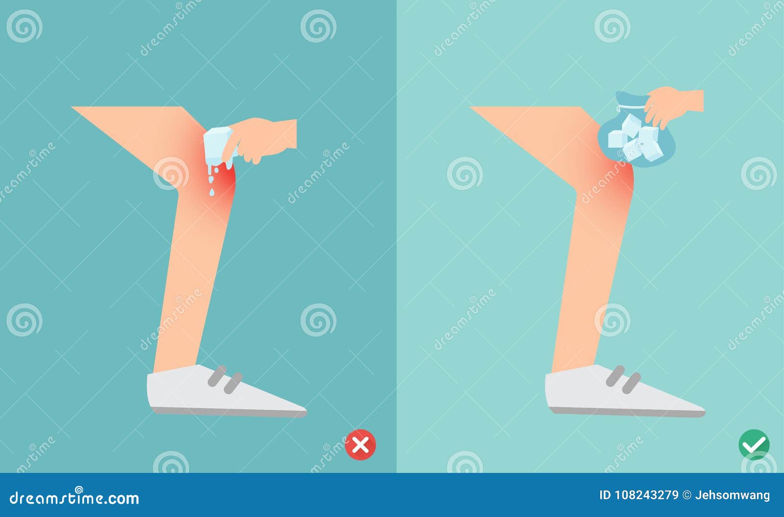 Wrong and Right Ways First Aid of Using Cold Packs for Injury Stock ...