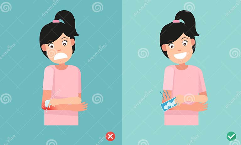 Wrong and Right Ways First Aid of Using Cold Packs for Injury Stock ...
