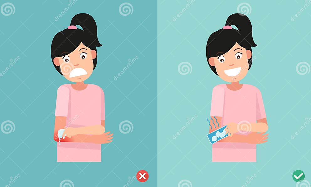 Wrong and Right Ways First Aid of Using Cold Packs for Injury Stock ...