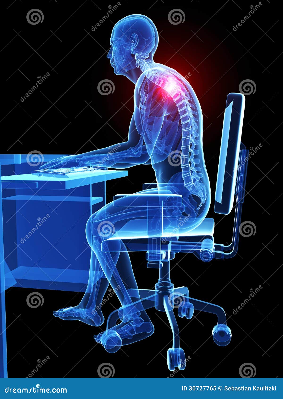 Wrong Sitting Posture Stock Illustration | CartoonDealer.com #30727765
