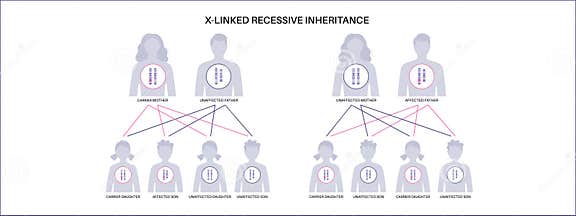 X Linked Recessive Inheritance Stock Vector - Illustration of person ...