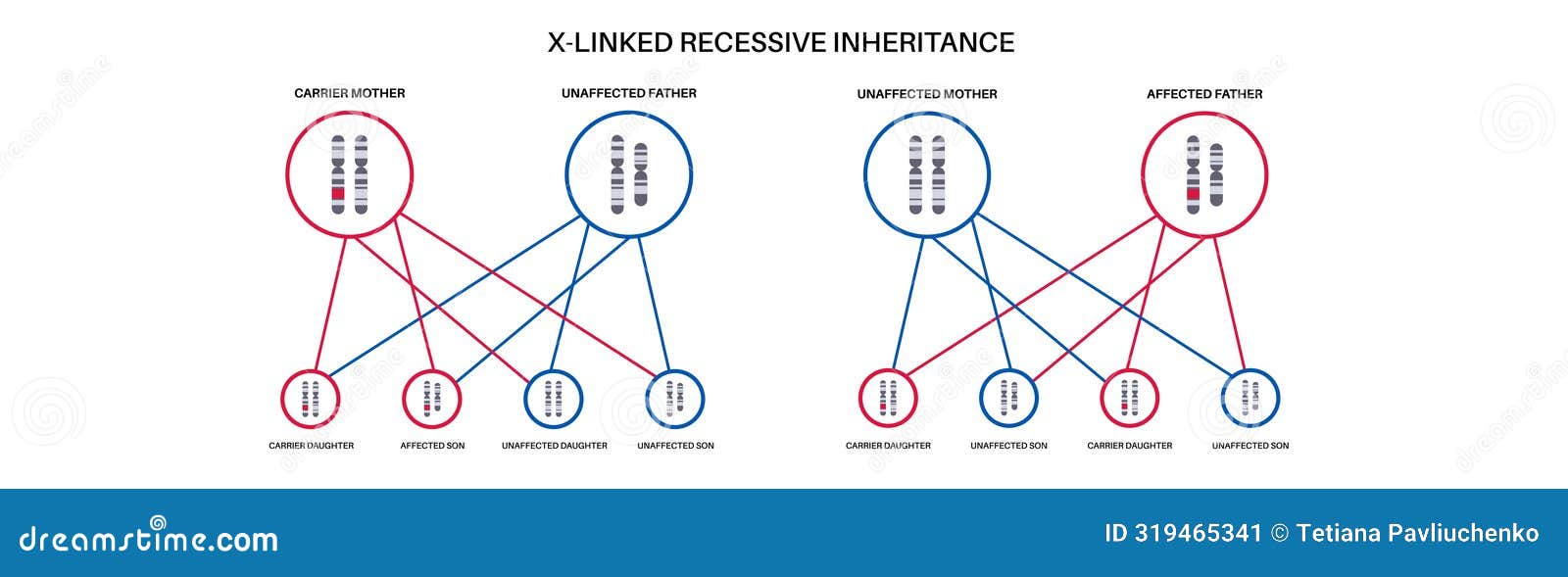 X Linked Recessive Inheritance Stock Vector - Illustration of recessive ...