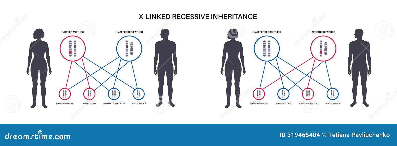 X Linked Recessive Inheritance Stock Vector - Illustration of linked ...