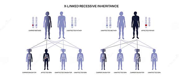 X Linked Recessive Inheritance Stock Illustration - Illustration of ...