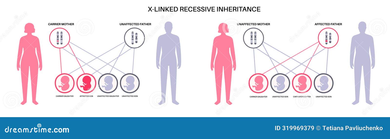 X Linked Recessive Inheritance Cartoon Vector | CartoonDealer.com ...