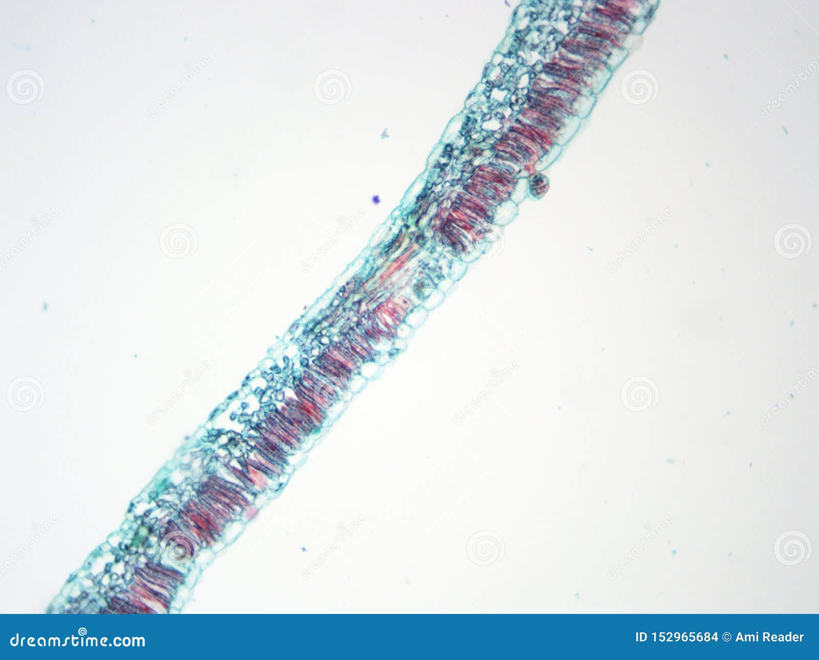 Spirogyra Under Compound Microscope