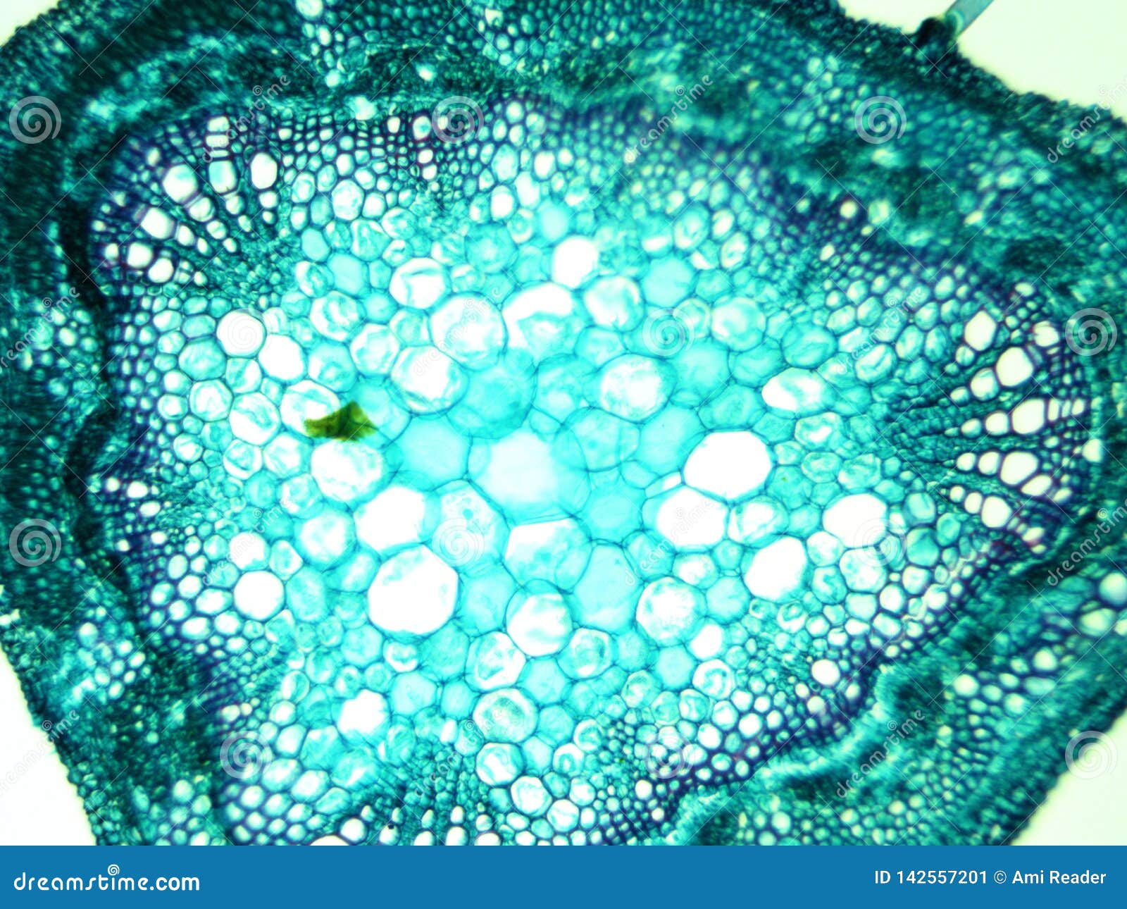 Soya Stem Cross Section 100x Cells Stock Image - Image of cell, nucleus ... Soya Stem Cross Section 100x Cells Stock Image - Image of cell, nucleus ...