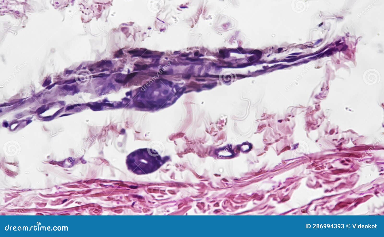 400x Magnification of Simple Squamous Epithelium Filmed Under ...