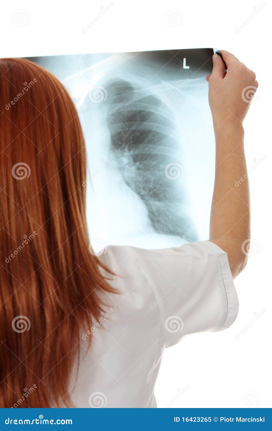 X-ray stock image. Image of diagnostic, isolated, professional - 16423265