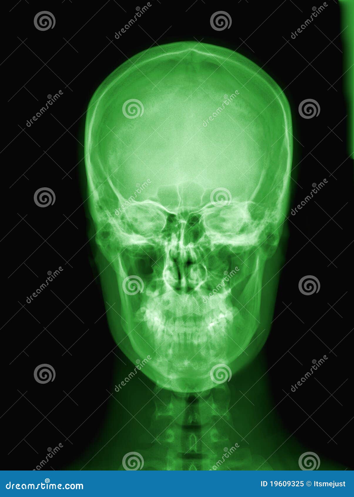 X-ray of Alien s skull. stock image. Image of space, bone - 19609325