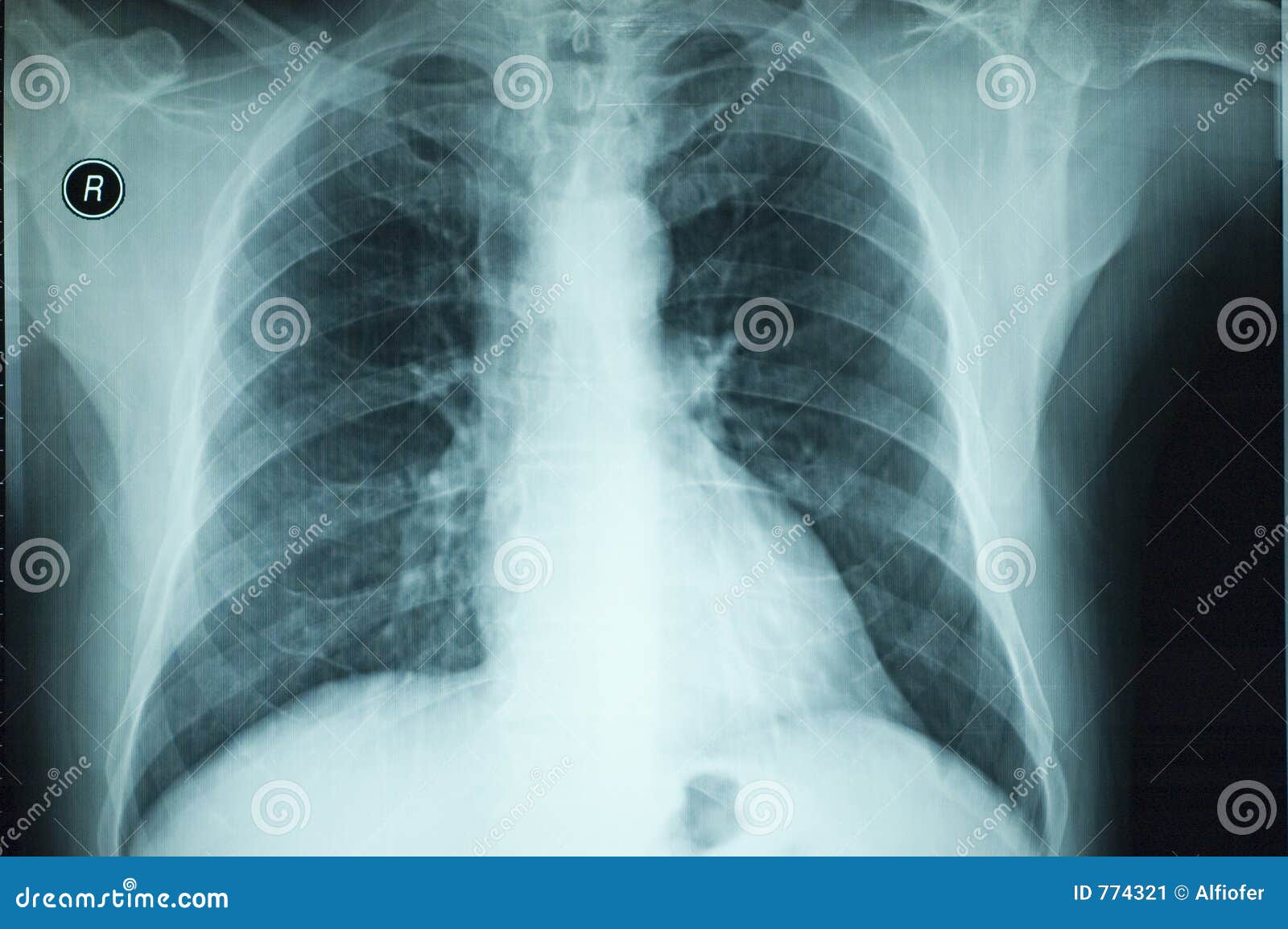 X RAY BODY PARTS stock image. Image of anaesthesia, skeletal - 774321