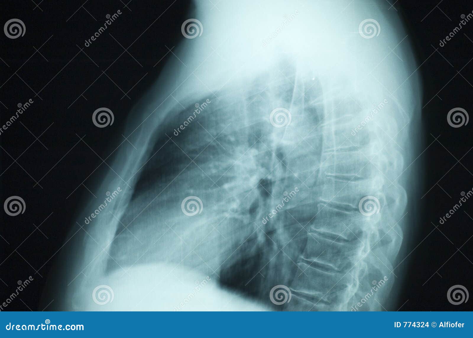 X RAY BODY PARTS stock photo. Image of painfulness, structure - 774324