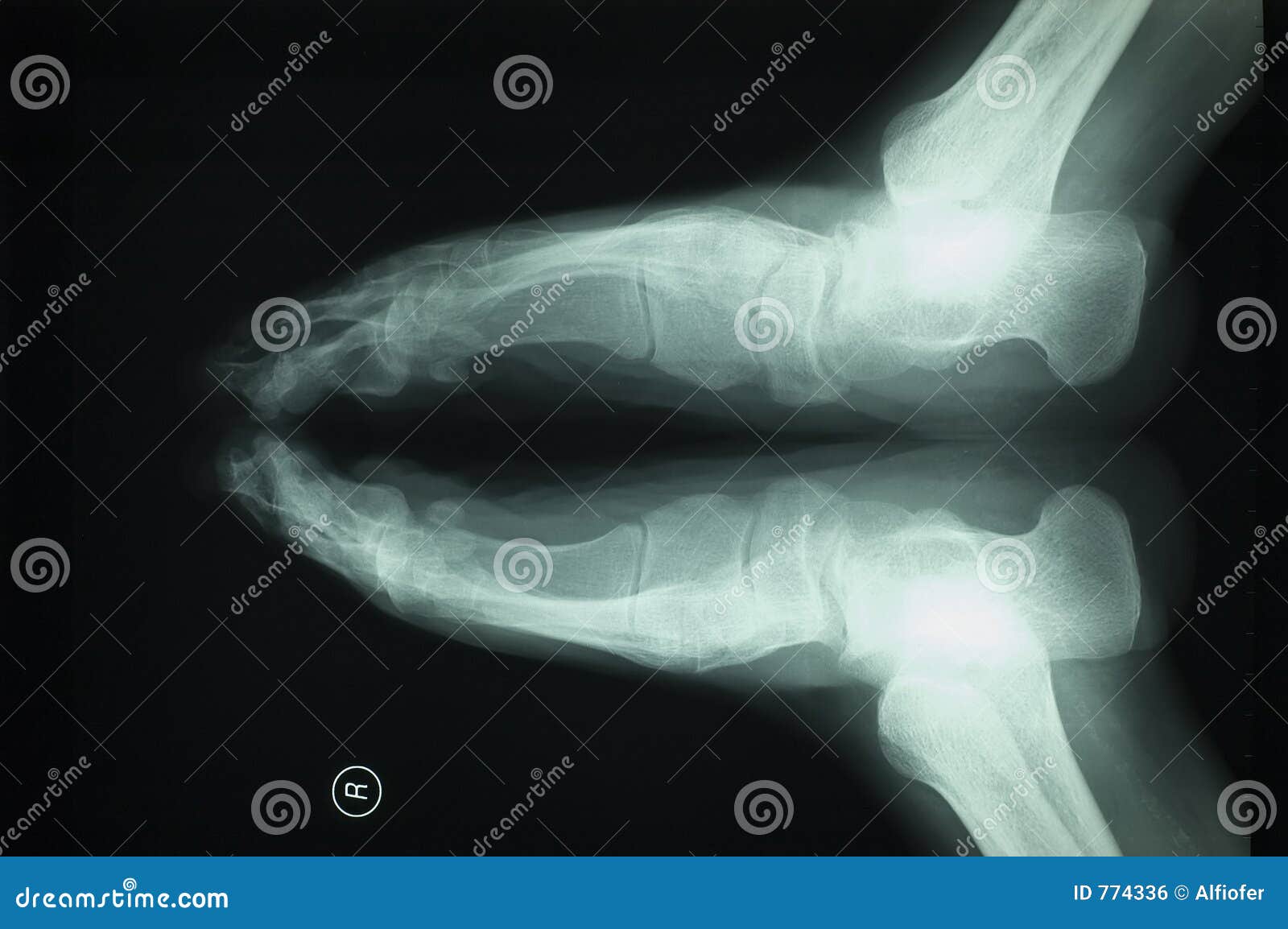 X RAY BODY PARTS stock photo. Image of physician, pain - 774336