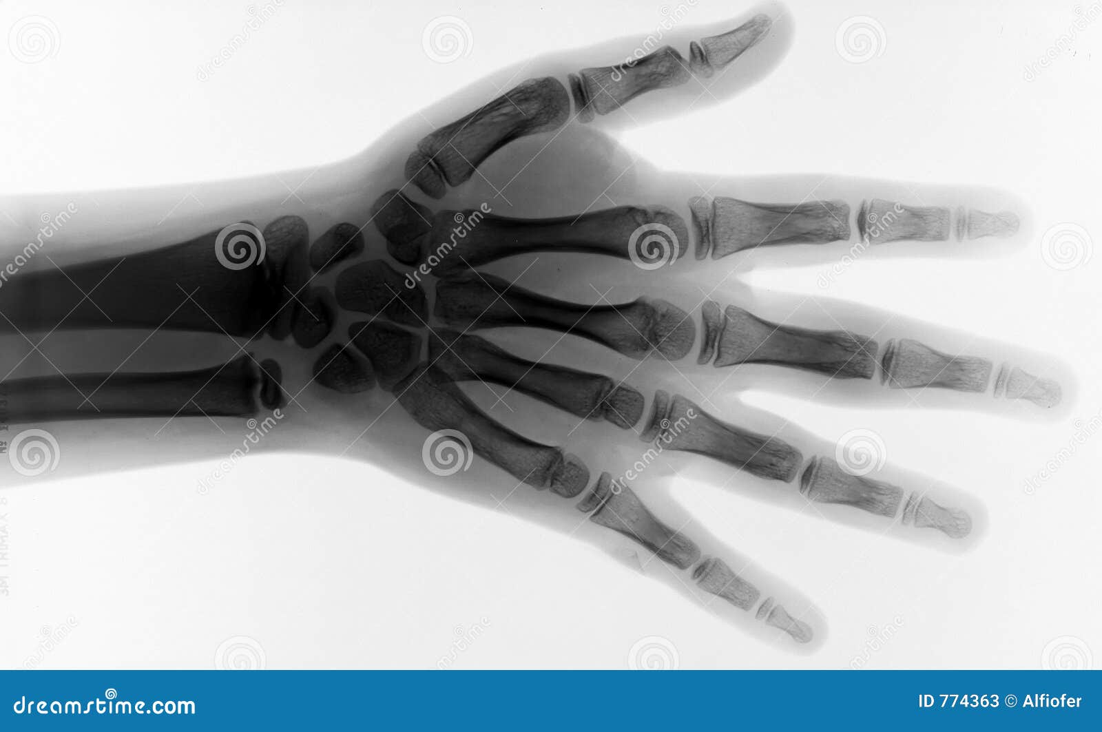 X RAY BODY PARTS stock image. Image of health, examination - 774363