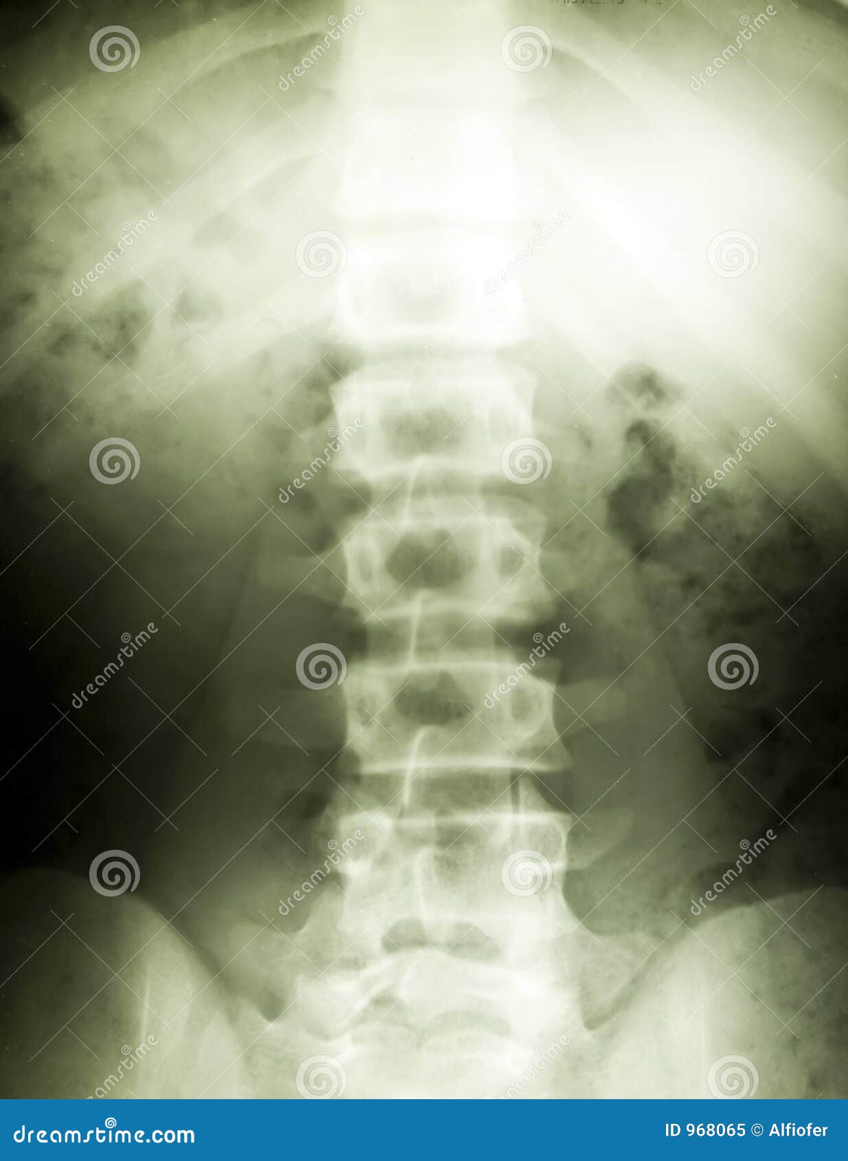 X ray body parts stock image. Image of laboratory, skeleton - 968065