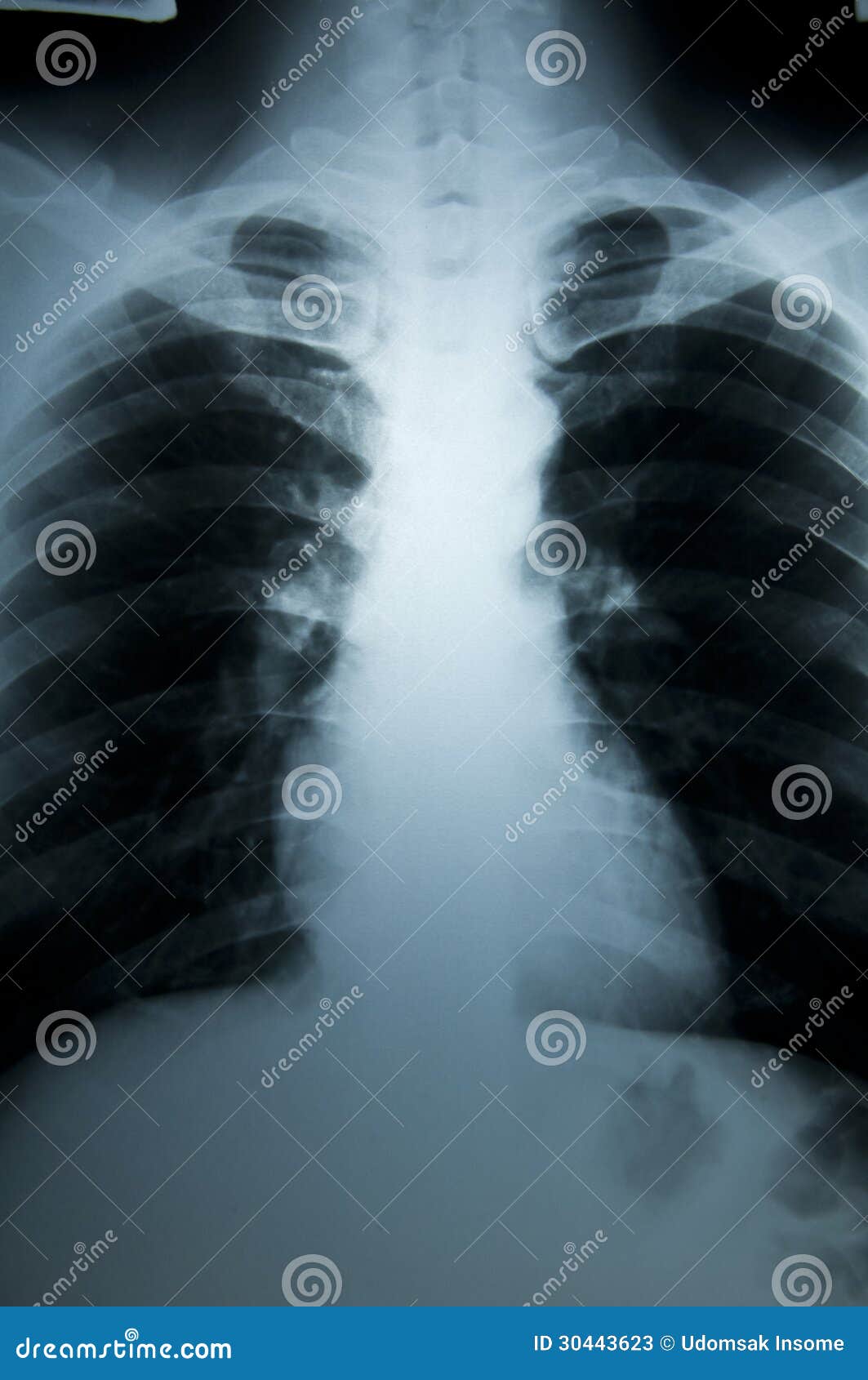 X-Ray body scan stock image. Image of health, abdomen - 30443623