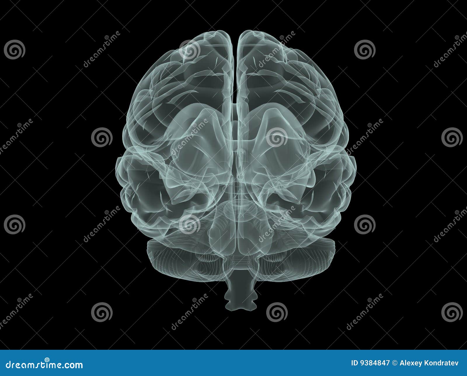 X-ray Brain Royalty Free Stock Photography - Image: 9384847