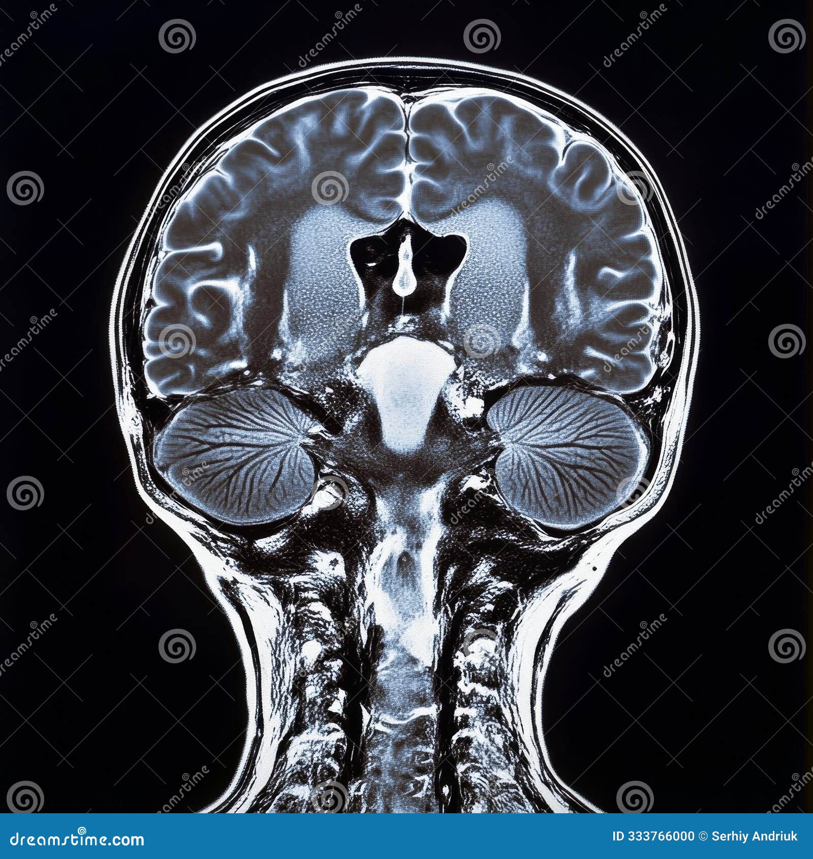 X-ray of the Brain. 3D Illustration, 3D Rendering Stock Illustration ...