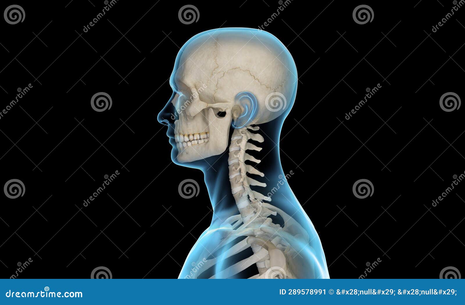 X Ray Of Cervical Section Of The Spine Royalty-Free Stock Image ...