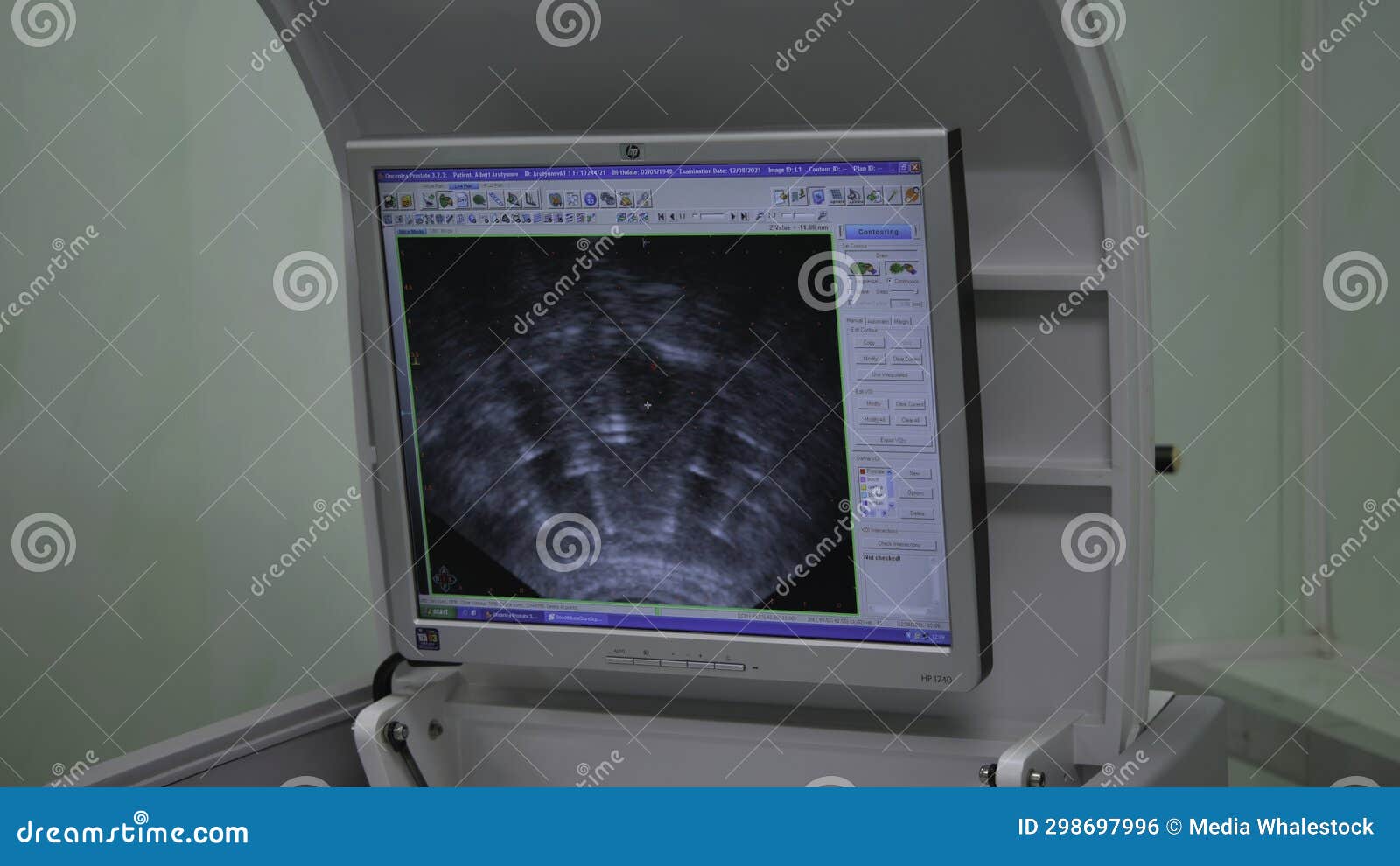 X-ray on the Computer. Creative. the Doctor S Office Where they Read ...