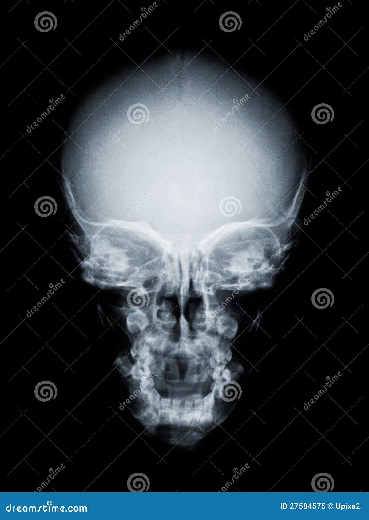 X ray cranium head stock image. Image of medical, diagnosis - 27584575
