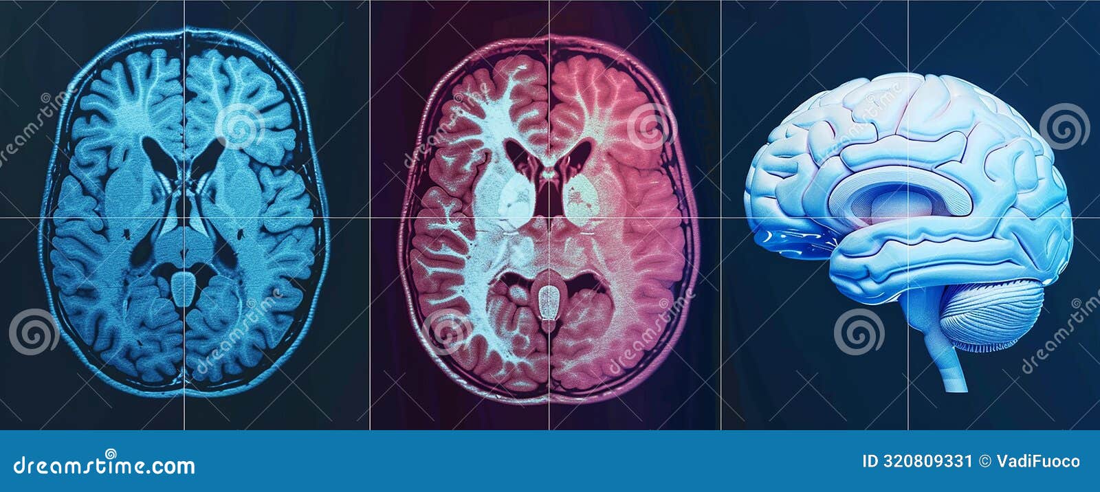 X-ray Cross-section of a Human Brain Stock Illustration - Illustration ...