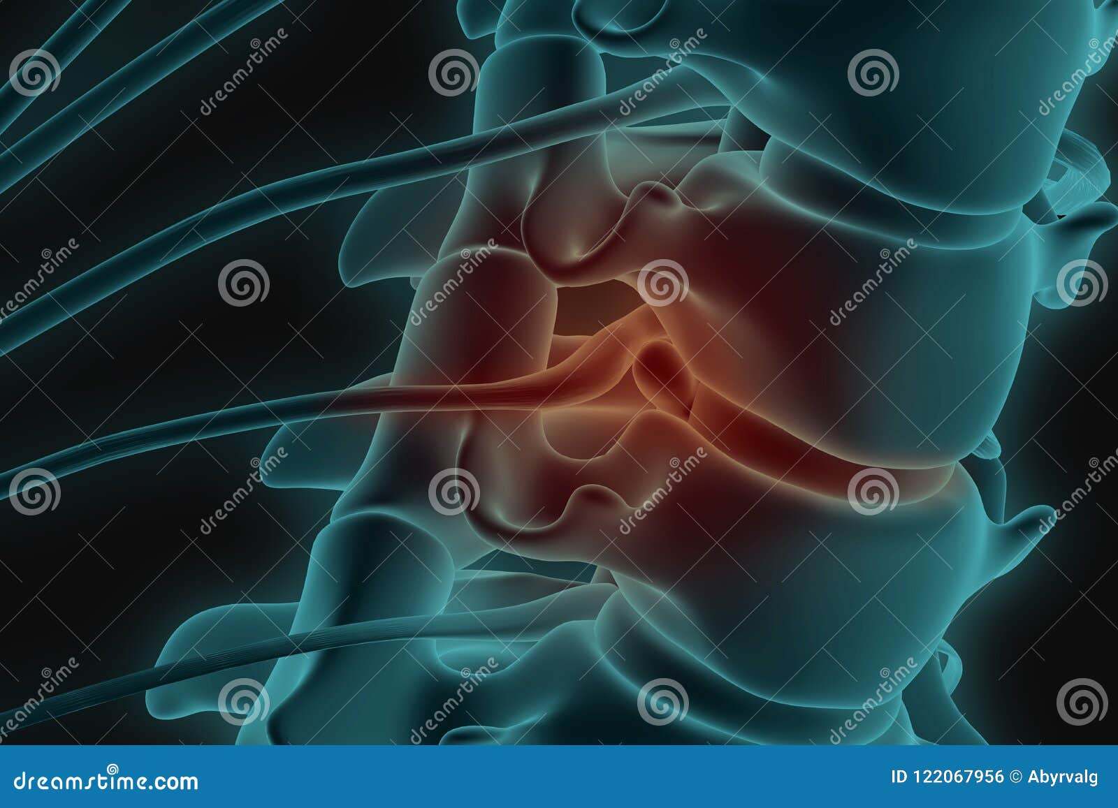 Nerve Root Anatomical Structure Labeled Cross Section Cartoon Vector ...