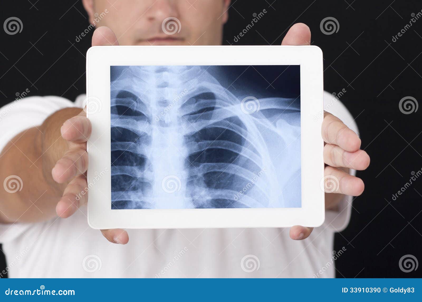 X-ray on the Digital Tablet Stock Photo - Image of bronchial, beauty ...