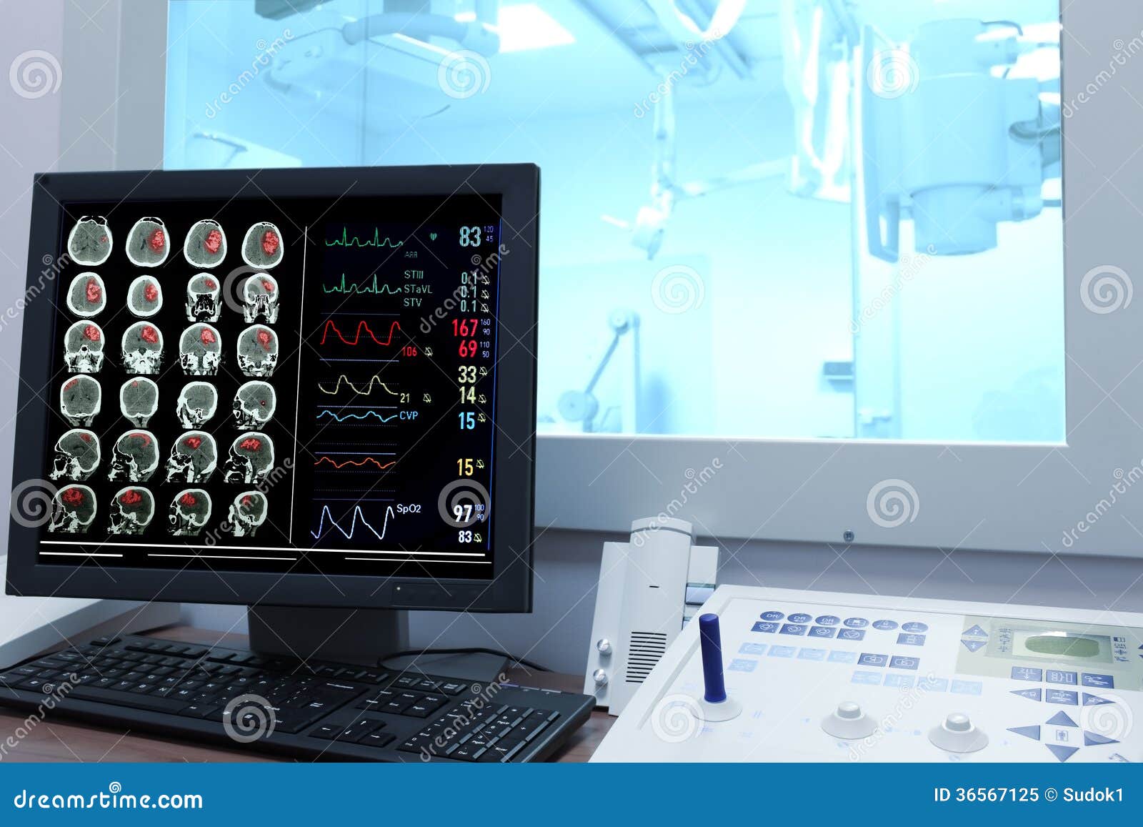 Ecg Ct Scan Human Brain Stock Photos - Free & Royalty-Free Stock Photos ...
