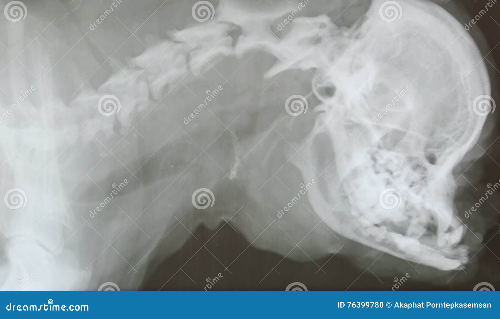 X-ray film of dog skull stock photo. Image of organs - 76399780