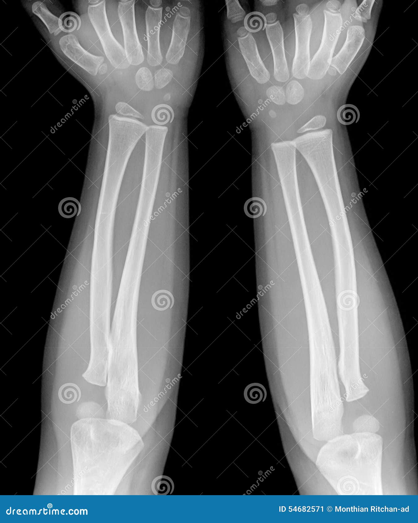 X-ray Stock Photo - Image: 54682571